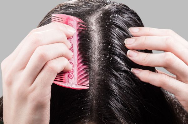 Seborrea y tratamiento - Inué - Coloración vegetal